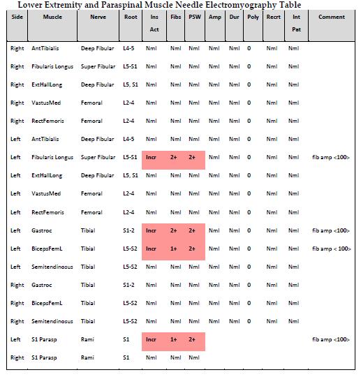 S1 Radiculopathy in a Young Adult: A Conjoined/Bifid Nerve Root ...